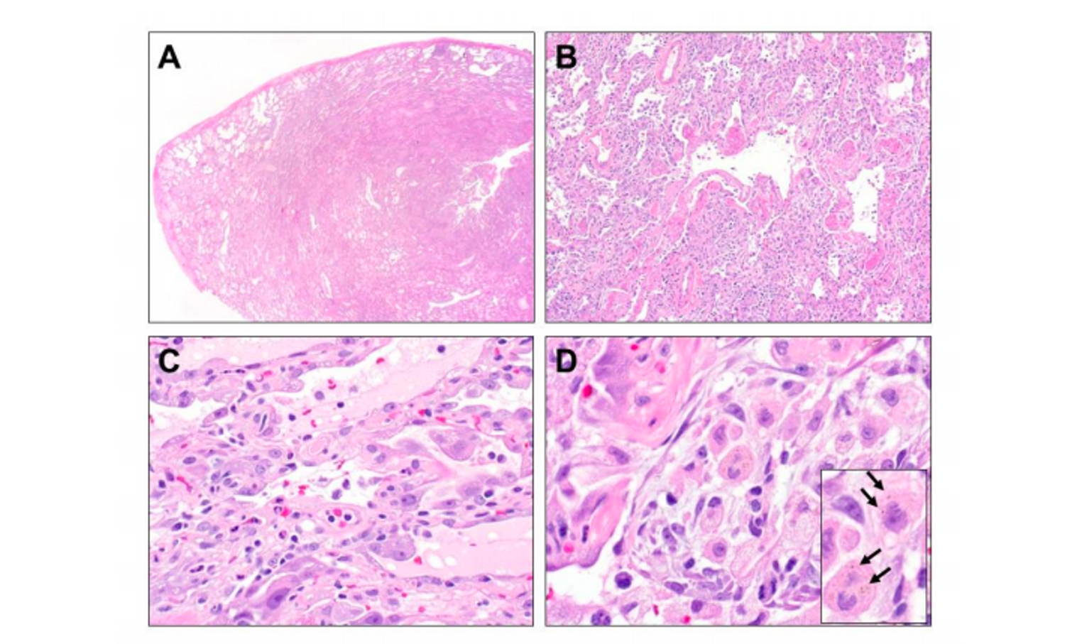 Study Shows Injuries From Vaping Look Like Chemical Burns | Phoenix New ...